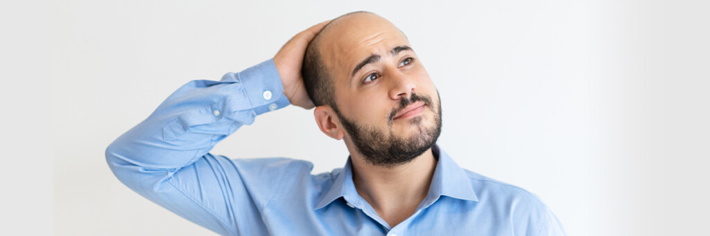 Male Hair Loss - ISHRS