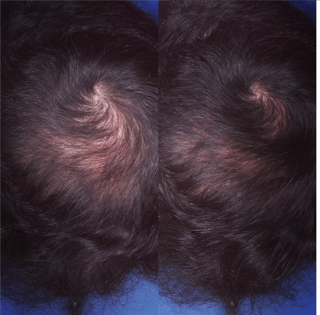 Discover Dr. Gorana Kuka Epstein's Journey into Regenerative Medicine ...