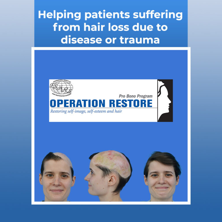 Discover the Gold Standard in Hair Restoration Treatment with the ISHRS